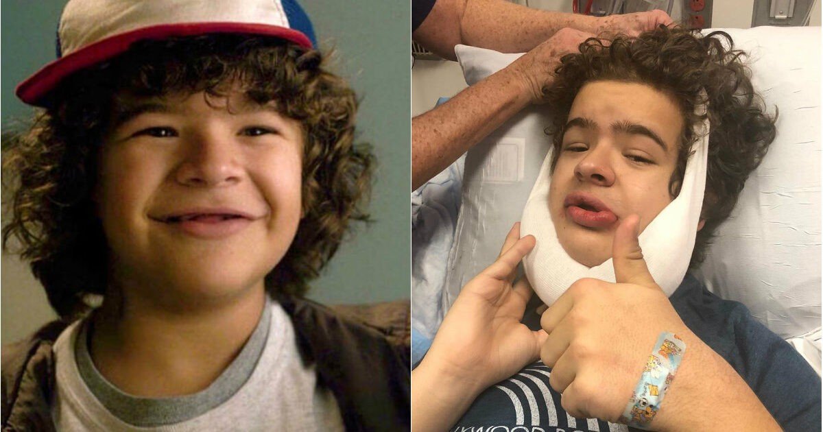 Astro de ‘Stranger Things’ passa por cirurgia para tratar síndrome ...