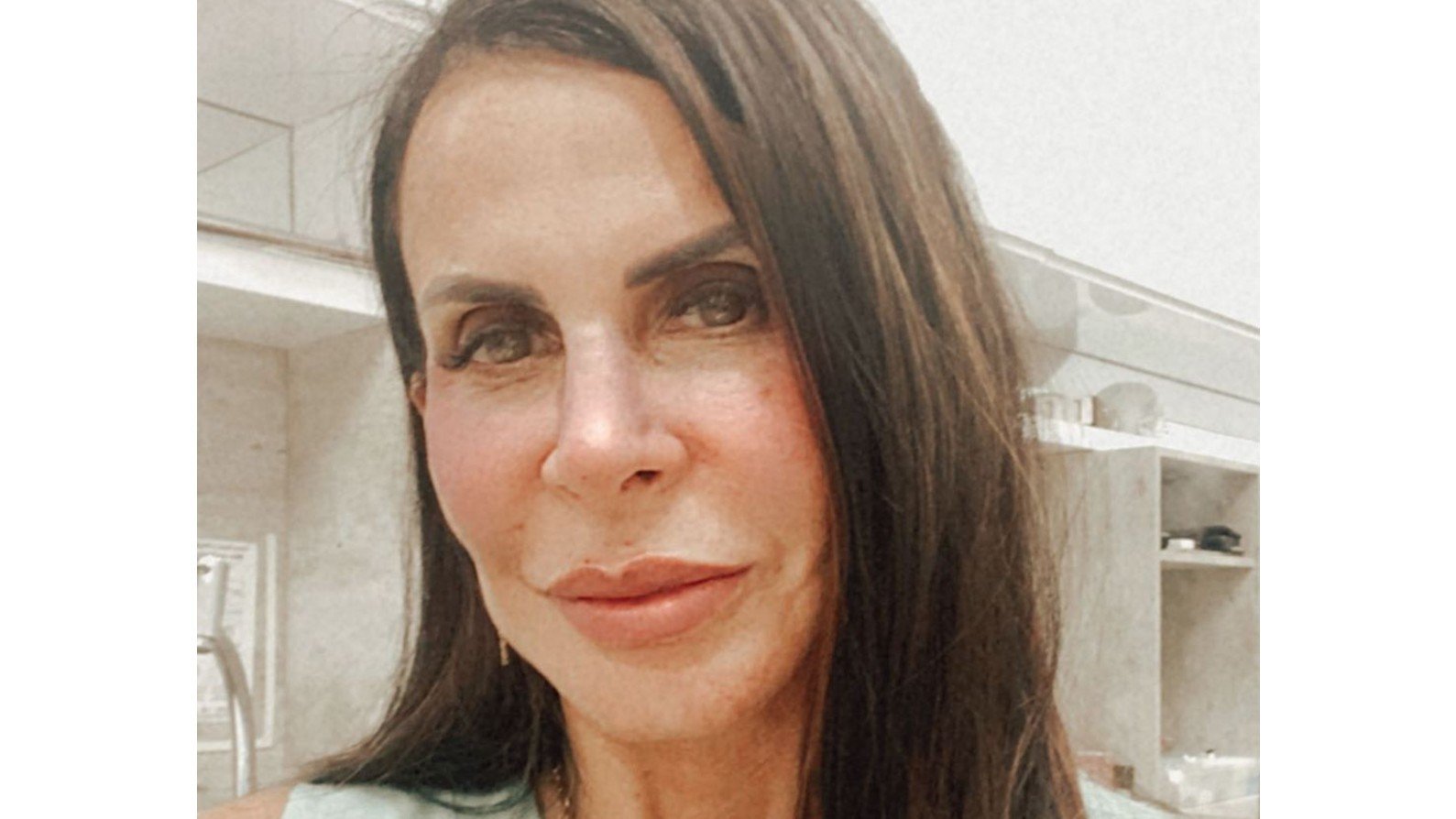 Gretchen compartilha resultado de nova harmonização facial - ISTOÉ ...