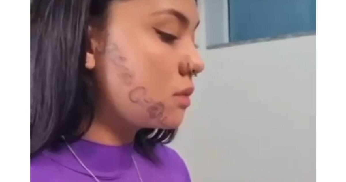 ‘Me sinto livre’, diz jovem ao iniciar remoção de tatuagem feita no ...