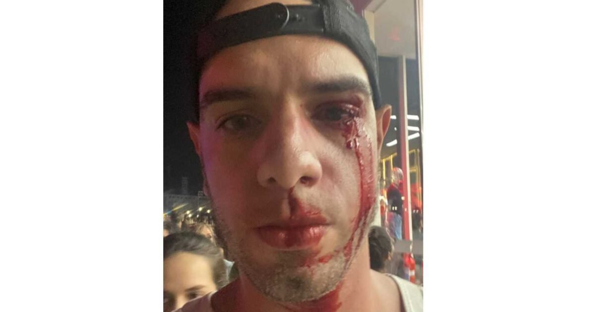Fotógrafo é agredido após esbarrar em menina sentada perto de palco no Rock in Rio - ISTOÉ ...