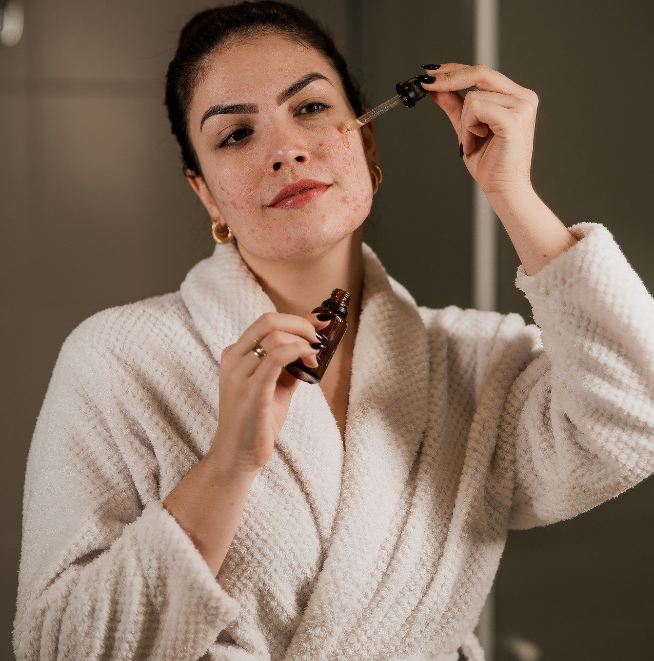 Terapeuta desenvolve método natural para controlar a acne e resultado ...