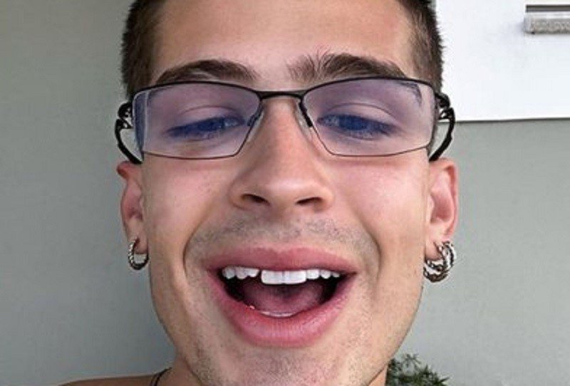 João Guilherme se diverte após quebrar parte do dente durante o Carnaval João Guilherme se diverte após quebrar parte do dente durante o Carnaval
