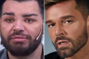 Ator faz 30 cirurgias plásticas para se parecer com Ricky Martin e ...