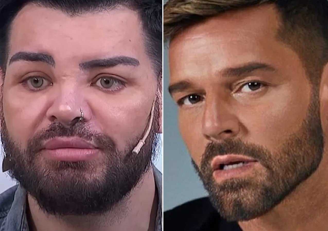 Ator faz 30 cirurgias plásticas para se parecer com Ricky Martin e ...
