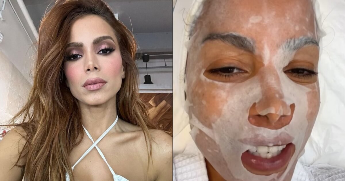 Anitta mostra procedimento com sangue para melhorar a pele íntima e do ...