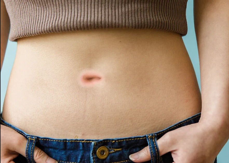 Mulheres usam umbigos falsos para que as pernas pareçam mais longas ...