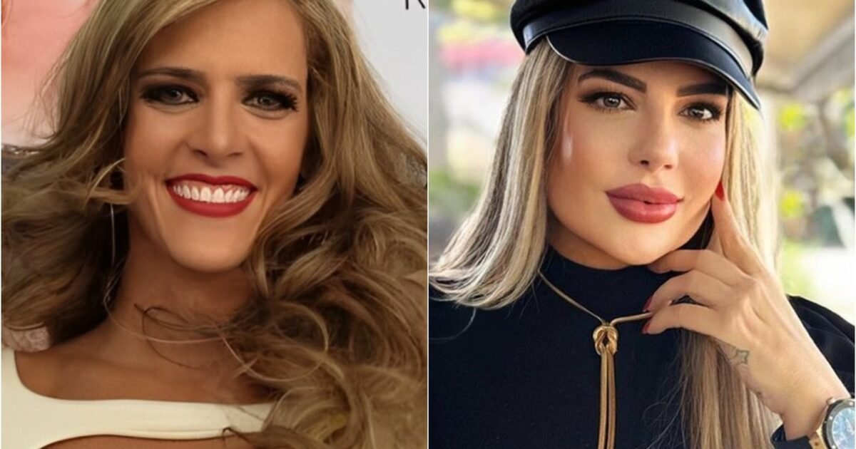 Denise Rocha surpreende ao mostrar nova harmonização facial; saiba ...