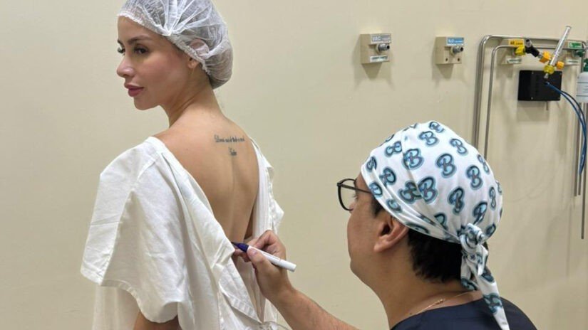 Cintura de Barbie: ex-panicat Babi Muniz mostra antes e depois de ...
