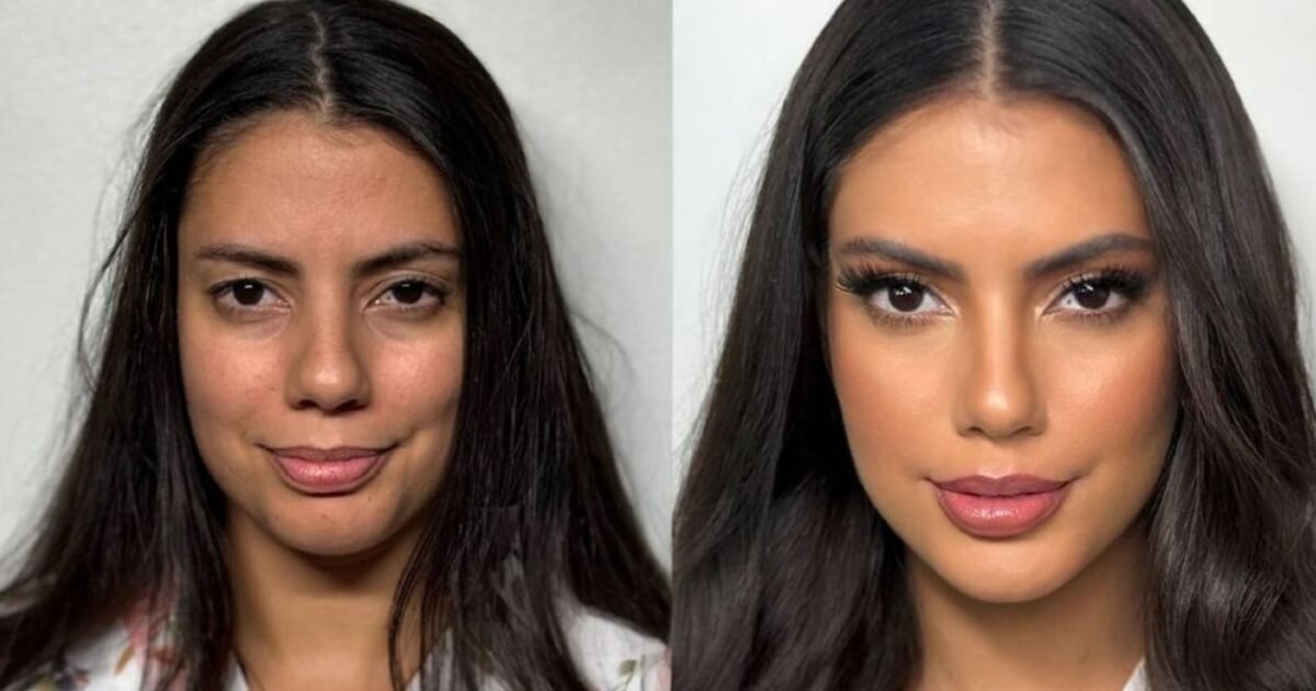 Saiba quais foram e quanto custam os procedimentos feitos por Fernanda ...