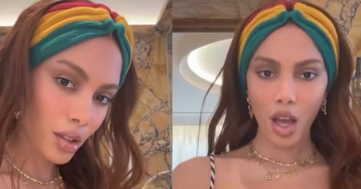 Saiba o valor do possível procedimento estético que mudou o rosto de ...