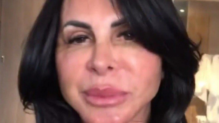 Gretchen faz novo procedimento estético no rosto e internautas a ...